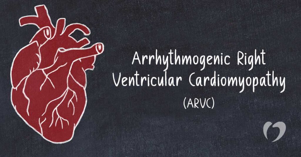 Arrhythmogenic Right Ventricular Cardiomyopathy - Oklahoma Heart Hospital