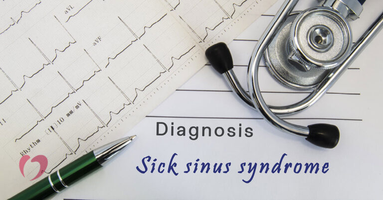 Sick Sinus Syndrome: Diagnosis and Treatment - Oklahoma Heart Hospital