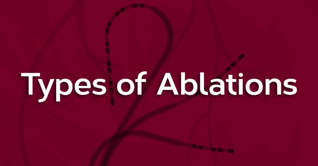 Types of Ablations to Treat Arrhythmia - Oklahoma Heart Hospital