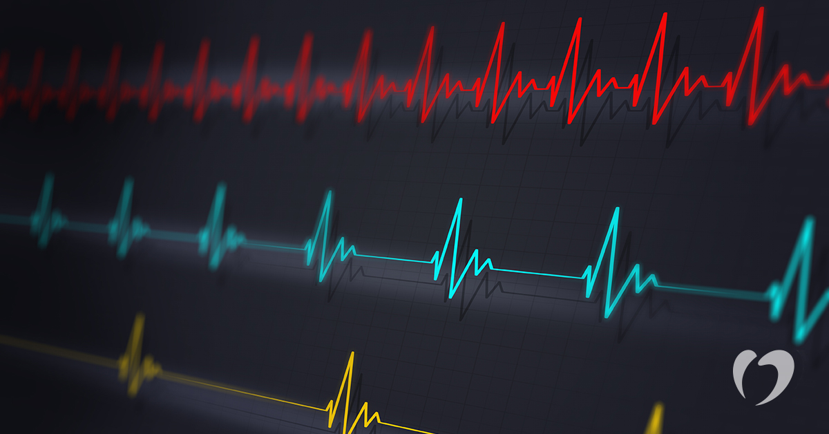 Complete Guide to Tachycardia - Oklahoma Heart Hospital
