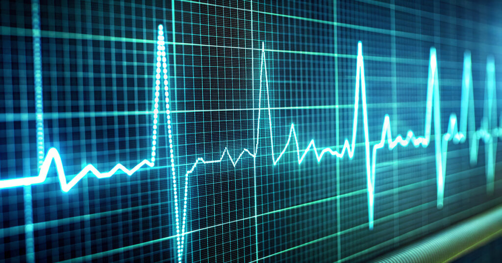 Understanding Heart Rate Variability - Oklahoma Heart Hospital